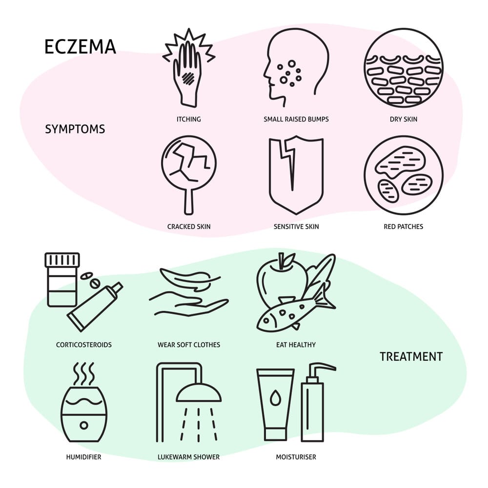 Psoriasis Vs Eczema: Let's Understand The Difference