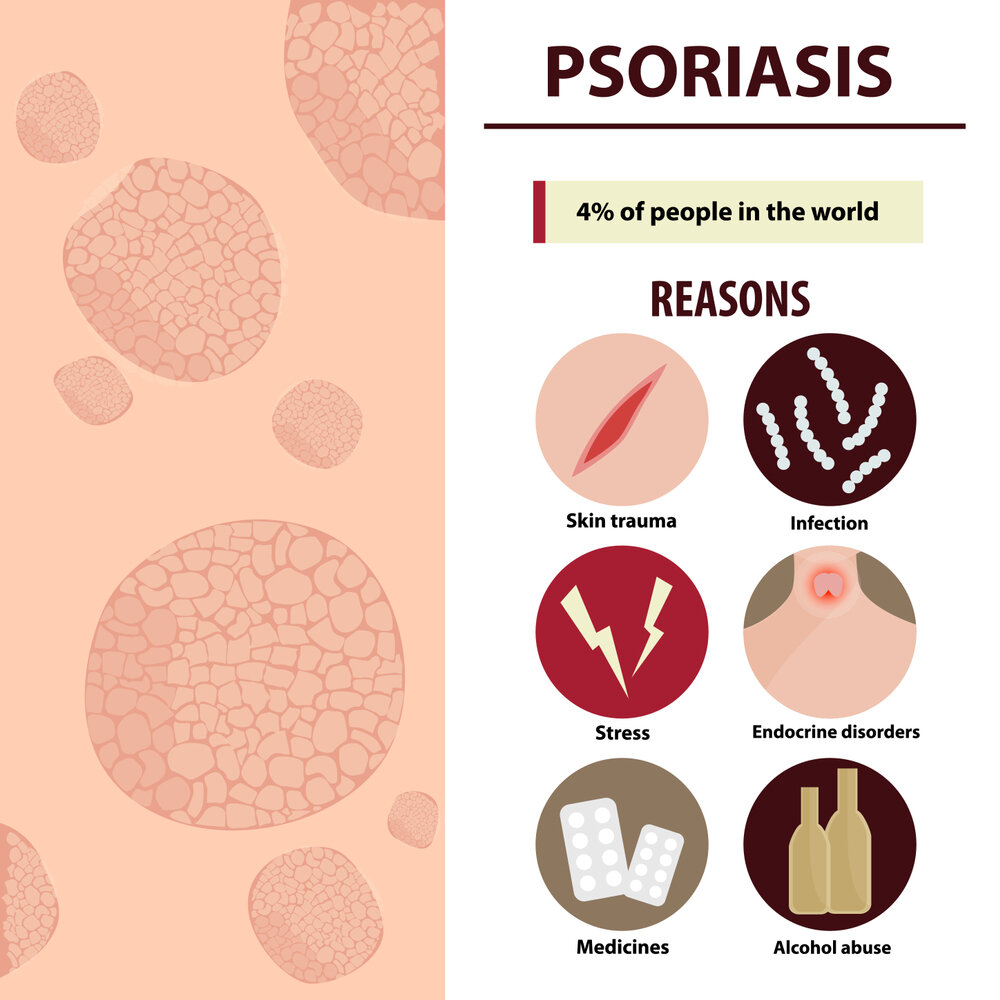 Psoriasis Vs Eczema Lets Understand The Difference
